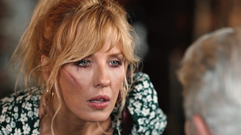 What Happened to Beth Dutton's Face on Yellowstone?